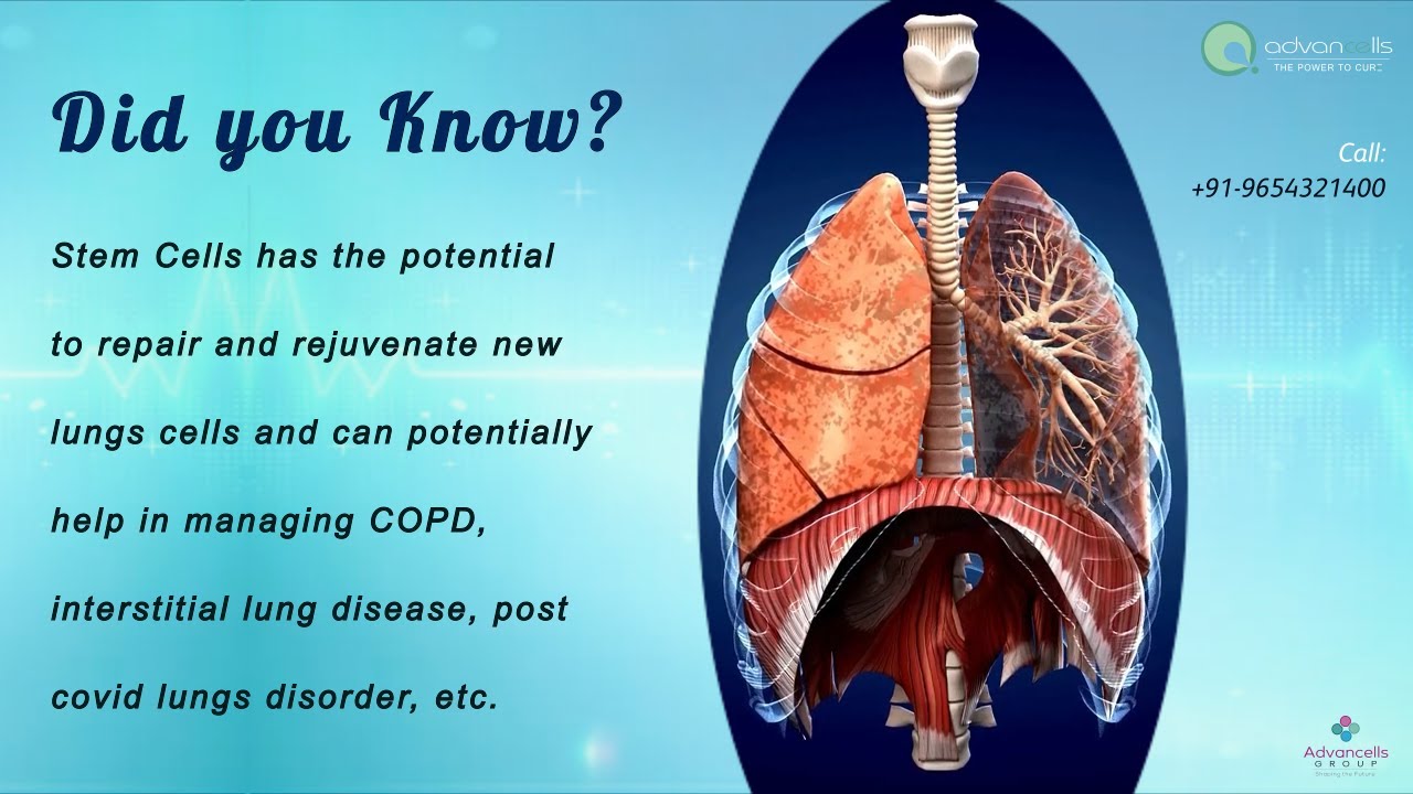 Lungs Rejuvenation through Stem Cells - YouTube