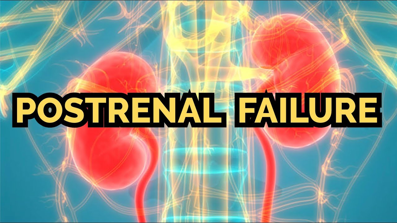 Postrenal Failure (updated 2023) - CRASH! Medical Review Series - YouTube