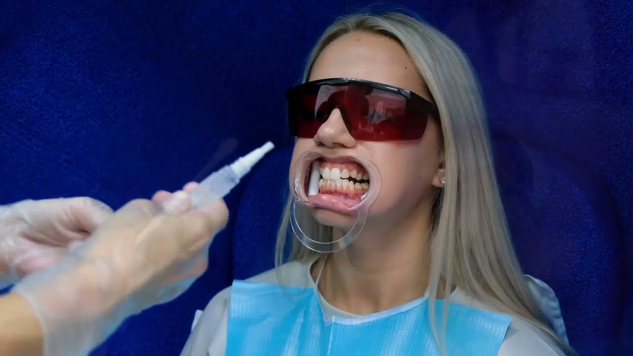 Paint on teeth whitening application method - YouTube