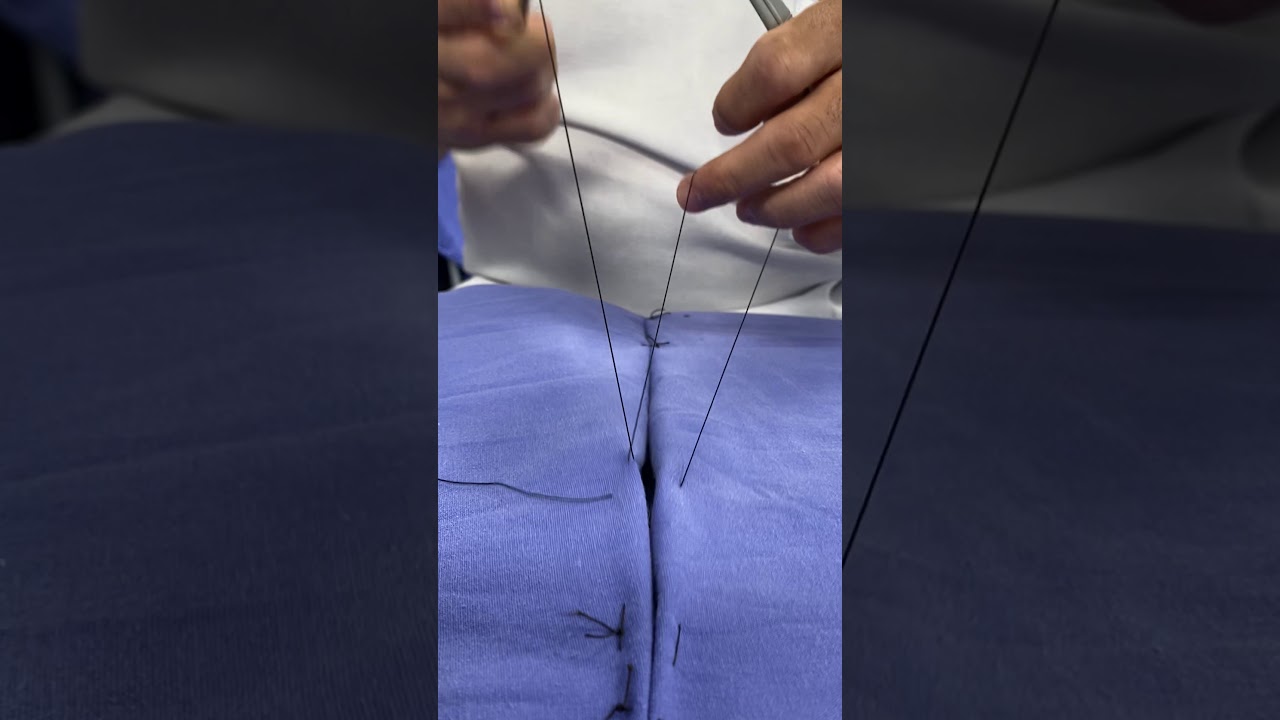 PUNTO EN X INVERTIDA - YouTube