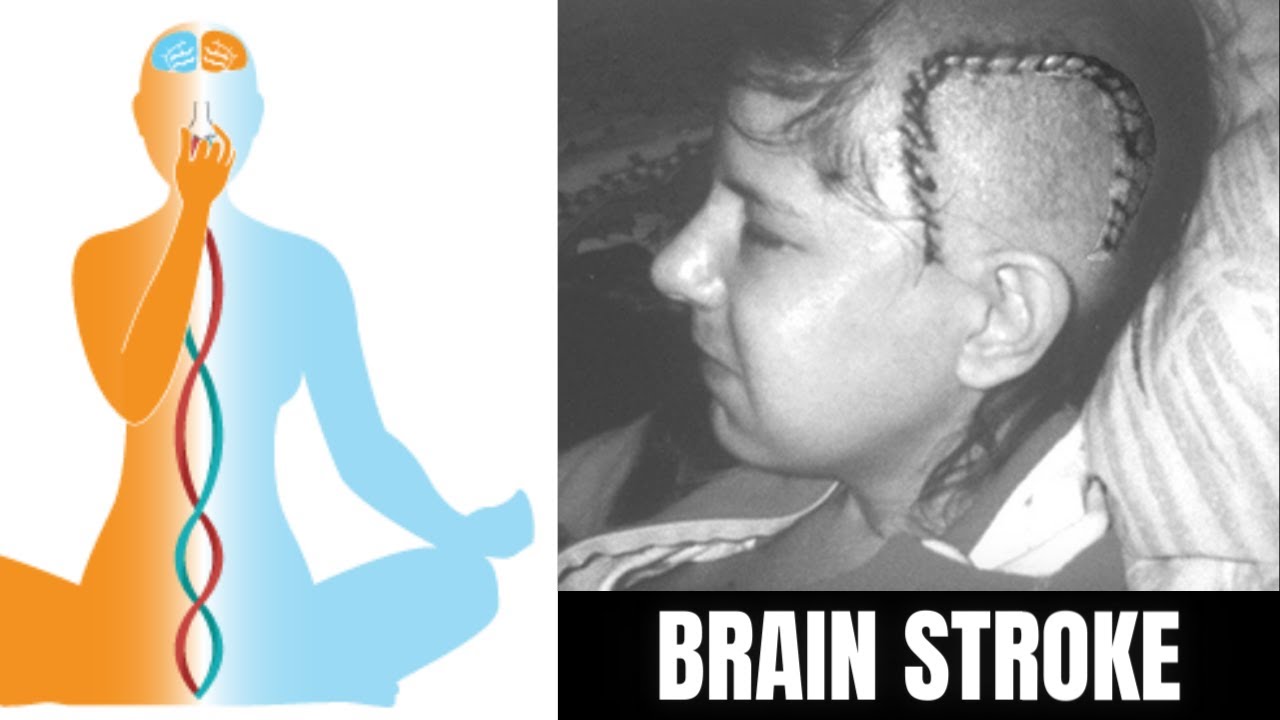 PRANAYAM Saved A American Neuroanatomist After Brain STROKE - Dr. B M ...