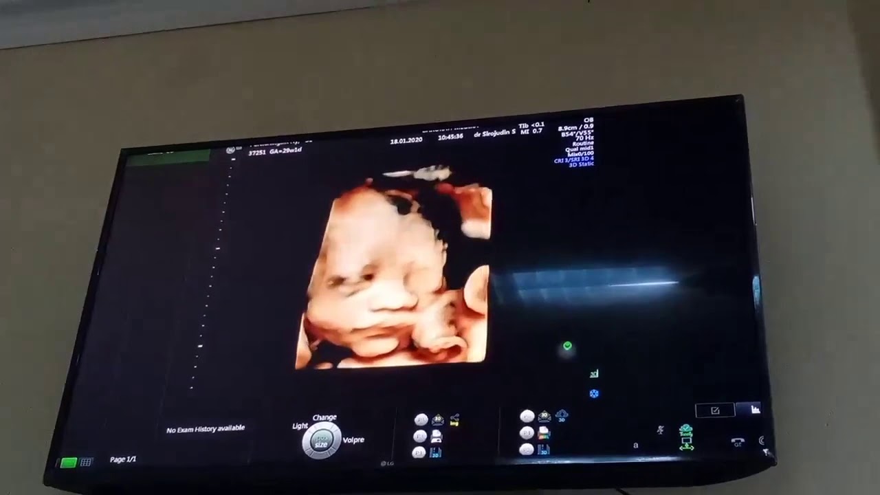 USG 4D usia kandungan 7 bulan - YouTube