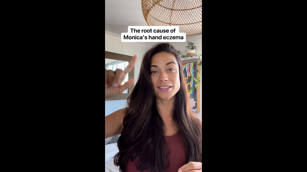 The root cause of Monica’s hand eczema - YouTube