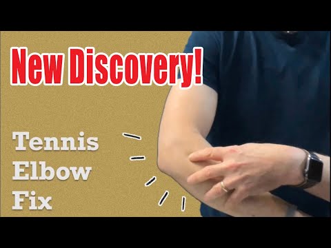 Überraschende Lösung bei Tennisarm + DIY-Handgelenksrolle – ANLEITUNG