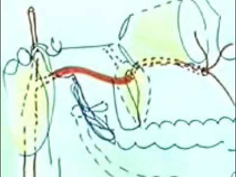 Head 09 - Arteries , Veins & Lymphatics Of Face - Dr Sameh Ghazy - YouTube