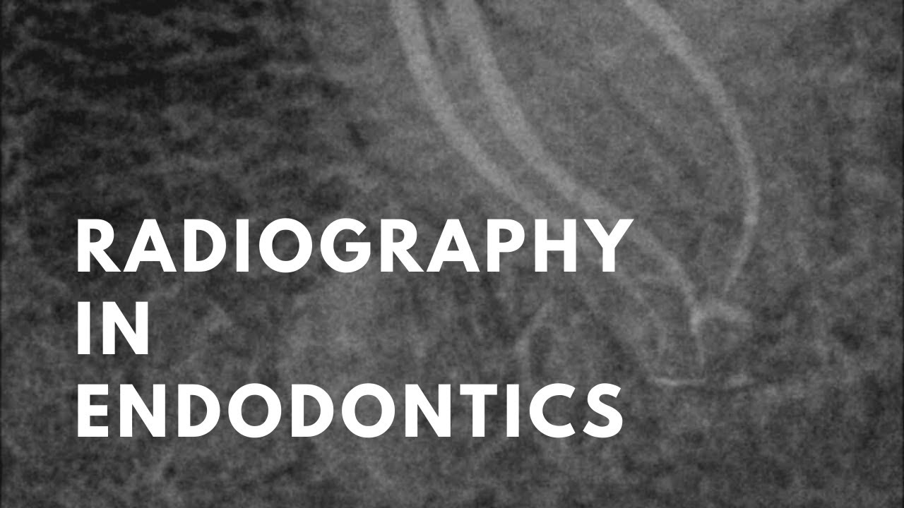 Radiography in Endodontics - YouTube