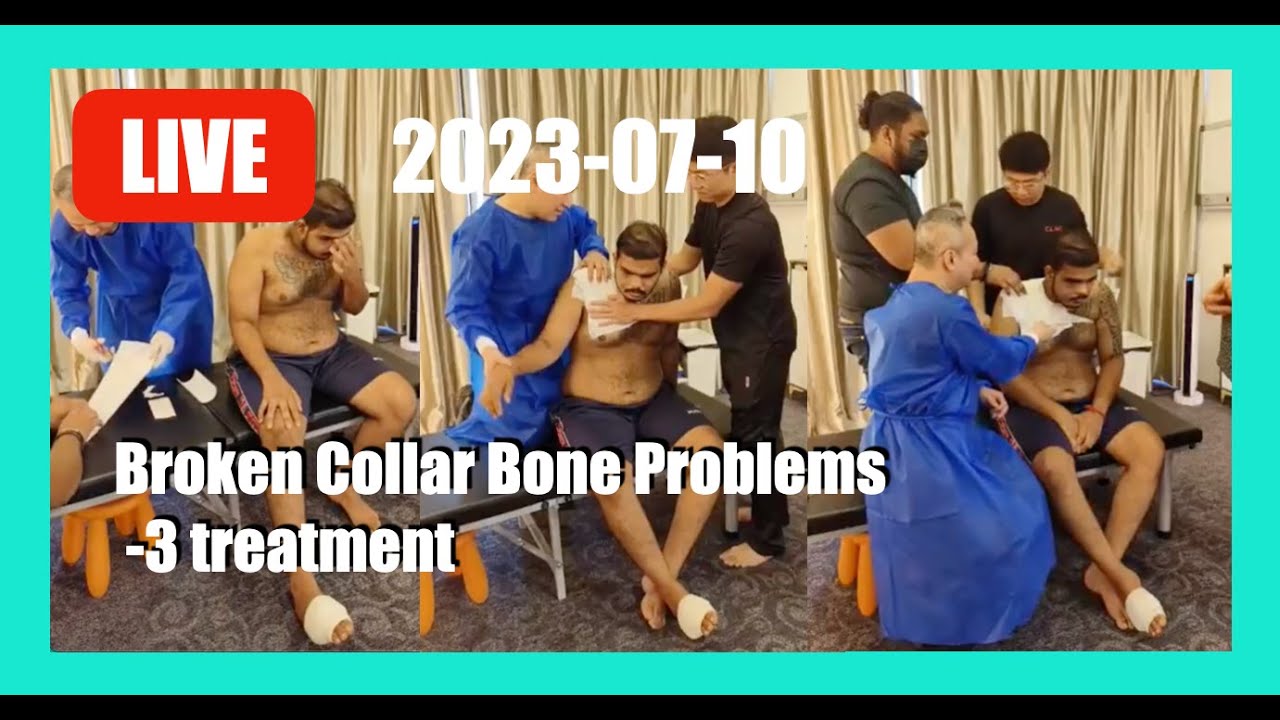 Broken Collar Bone Problems -3 treatment -5 - YouTube