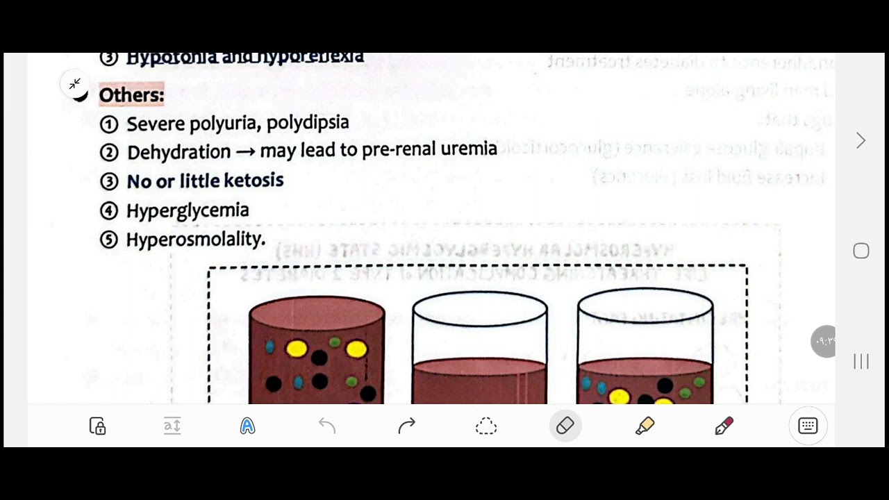 Emergency ( HHS, Hypoglycemic coma and lactic acidosis ) - YouTube