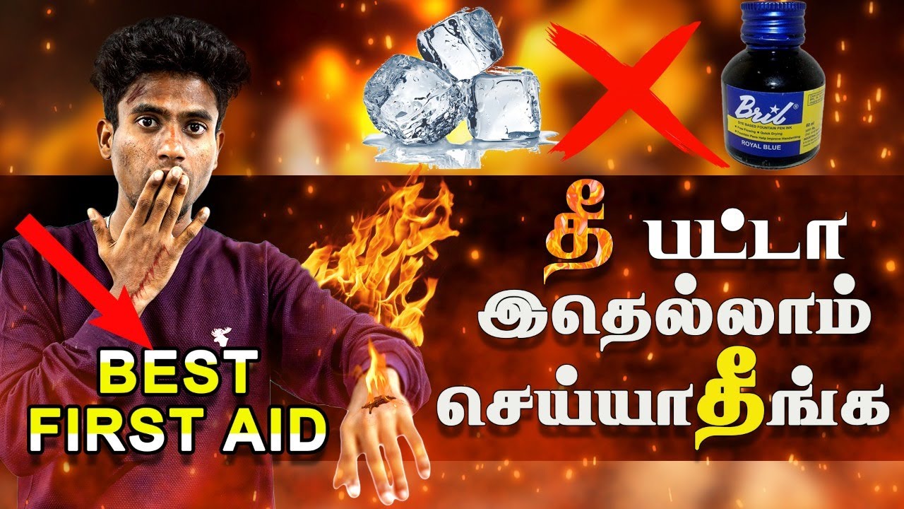 First aid for burn | How to treat burn : Basic first aid tips | - YouTube