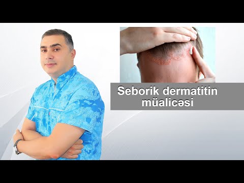 Seborik dermatitin müalicəsi