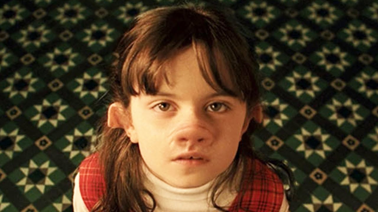 Girl Born With A Pig Face Should Live In Isolation Her Entire Life ...