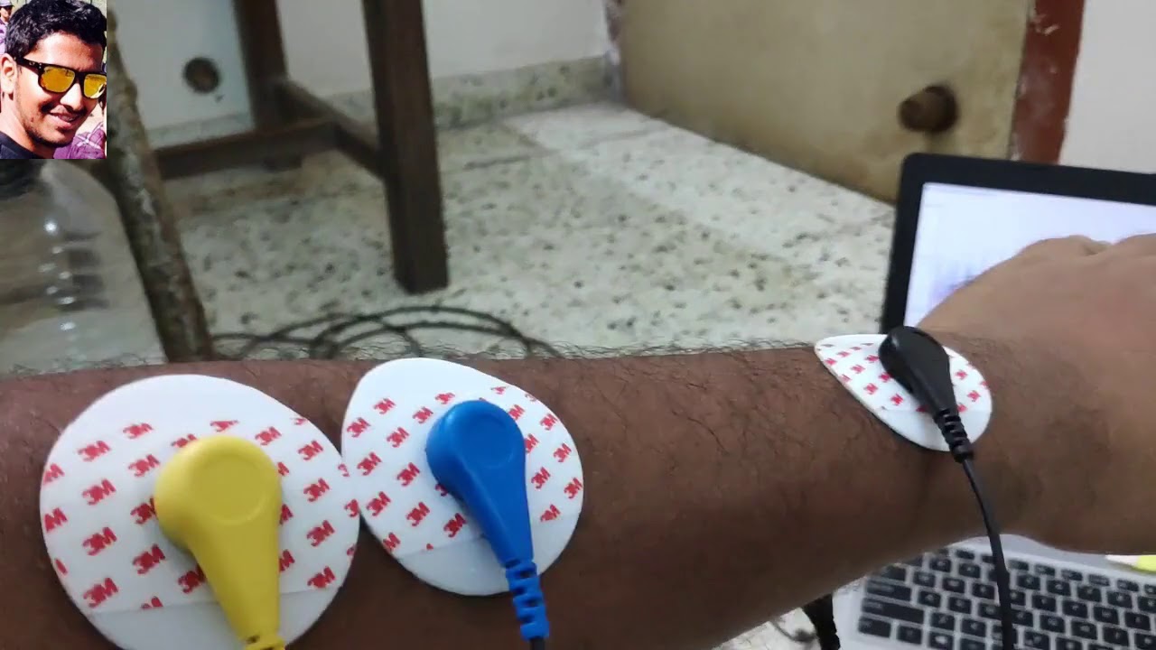 EMG data acquisition arduino - YouTube