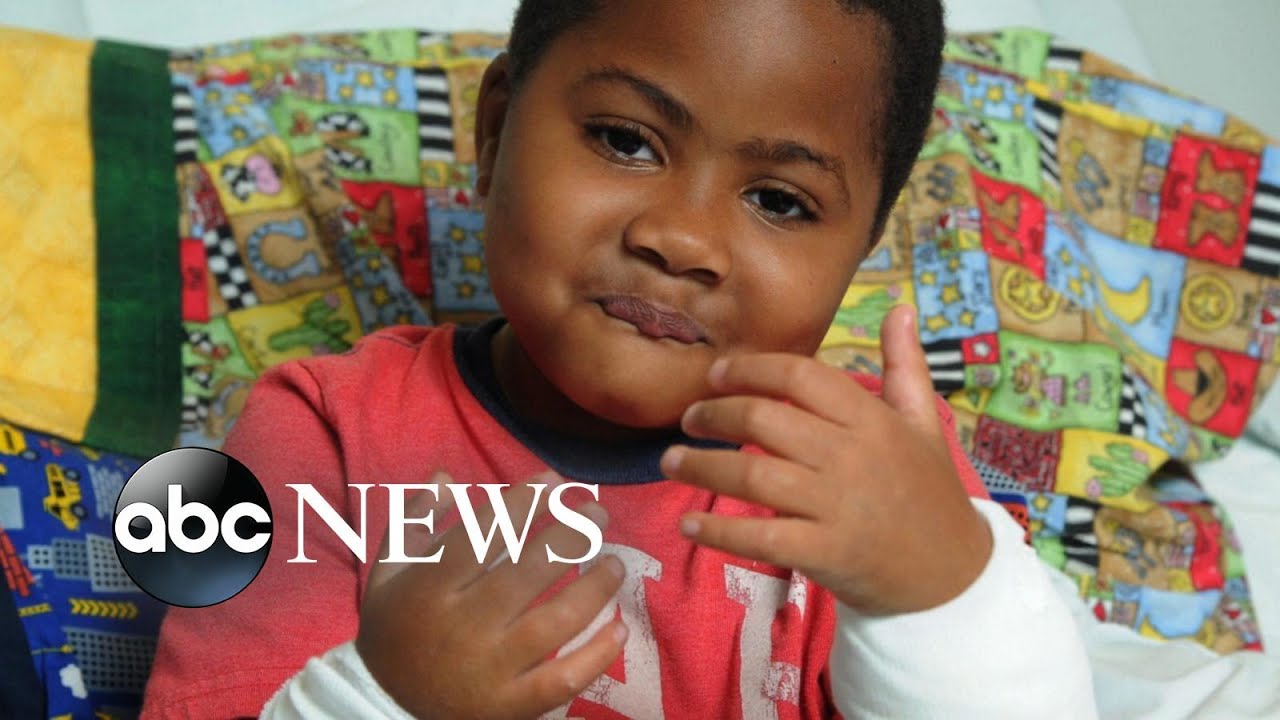 8-Year-Old Boy Receives Dual Hand Transplants - YouTube