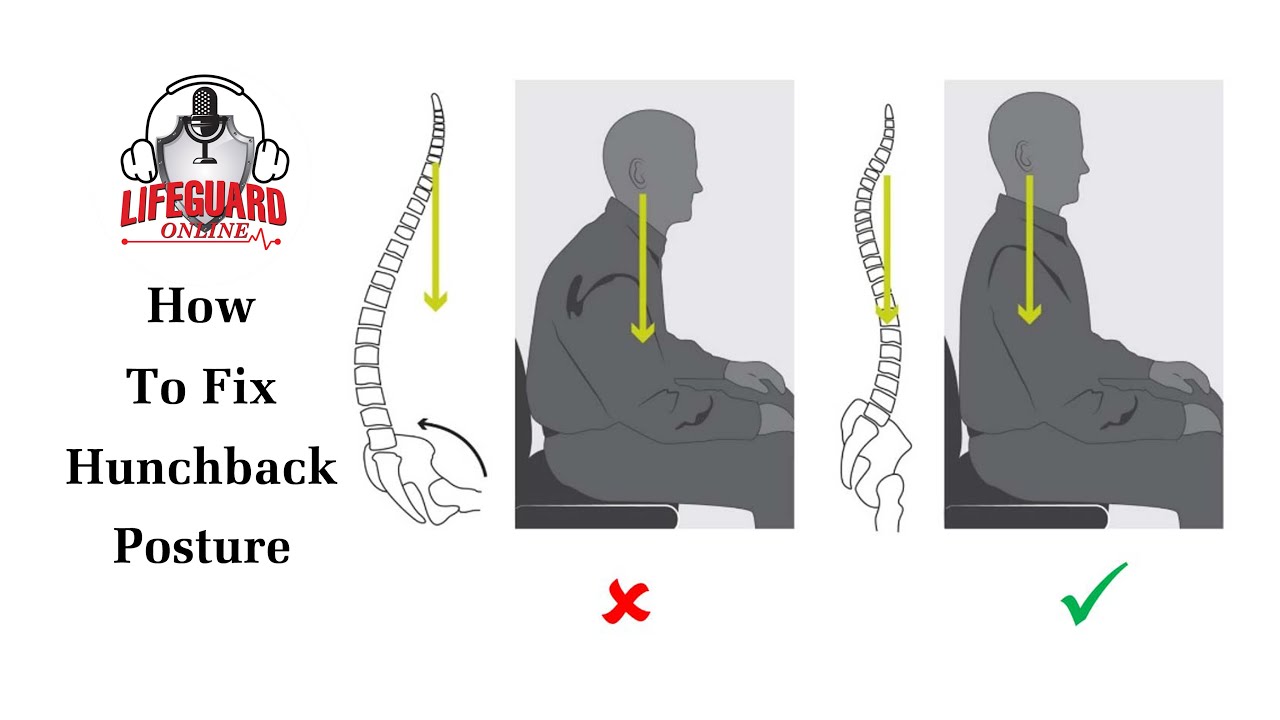 How to fix hunchback posture | Your Health | #hunchbackofnotredame # ...
