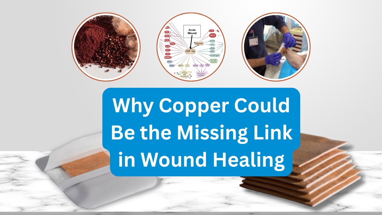 Why Copper Could Be the Missing Link in Wound Healing | MedCu Explains ...