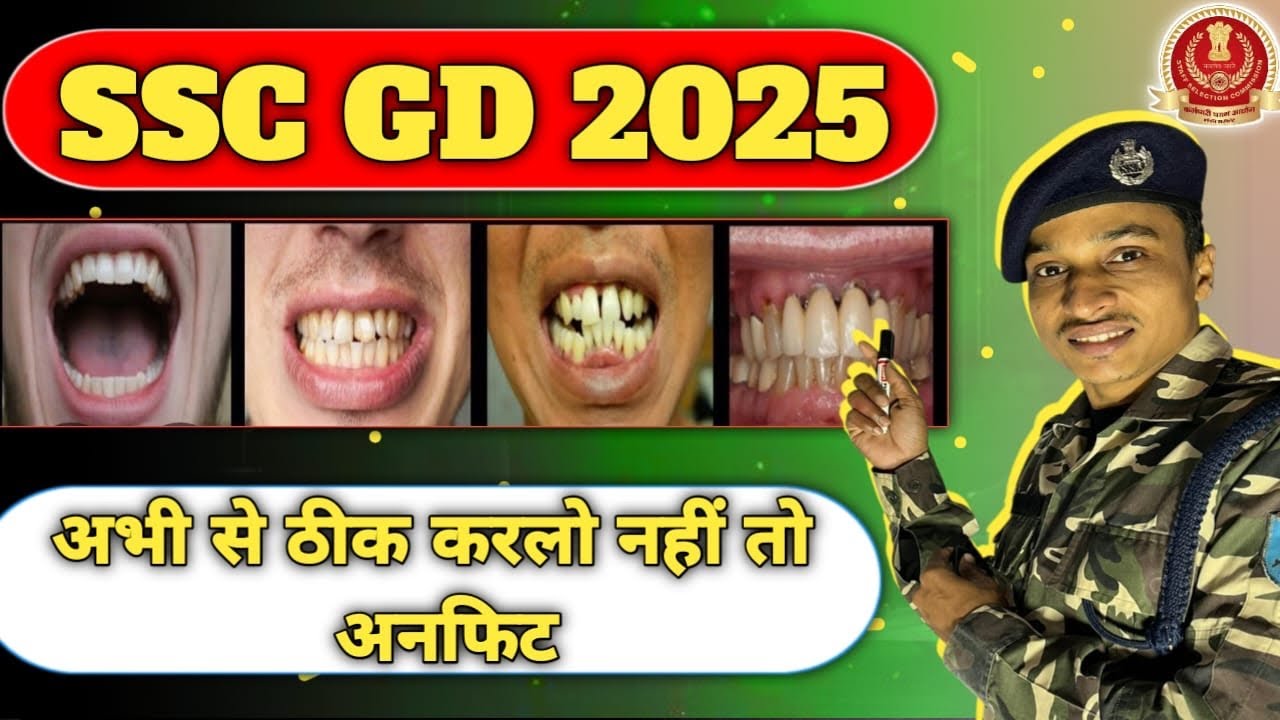 Ssc Gd Medical Teeth Test 20225 || Ssc Gd Medical Check Up 2025 # ...