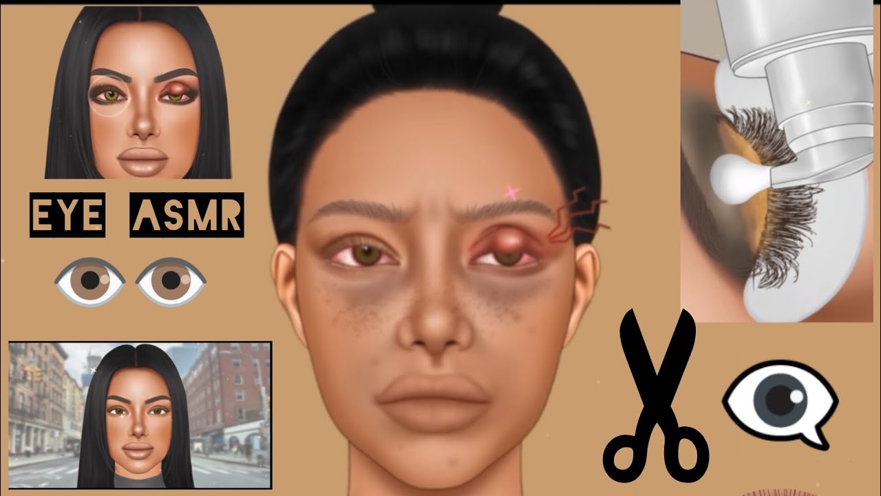 ASMR Remove unmanaged eyebrow piercing pus animation II Squeeze eyes ...