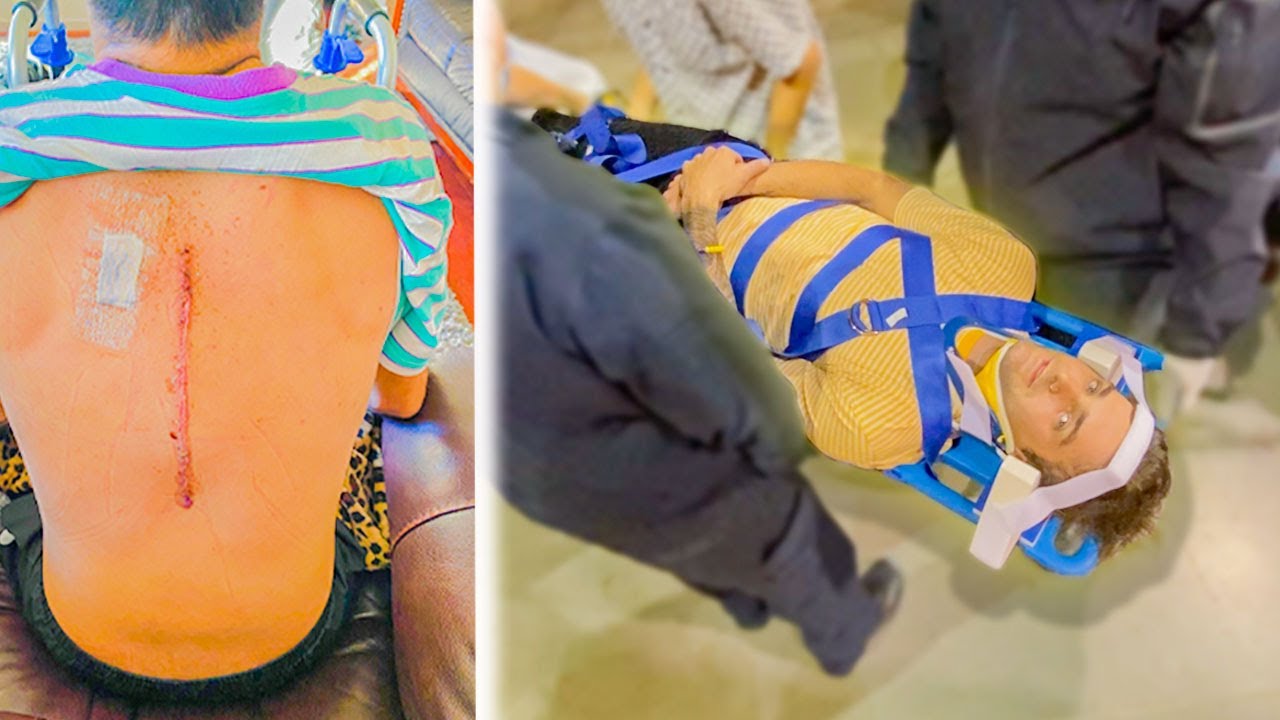 My Biggest Injury Caught On Camera...(Broke My Spine) - YouTube