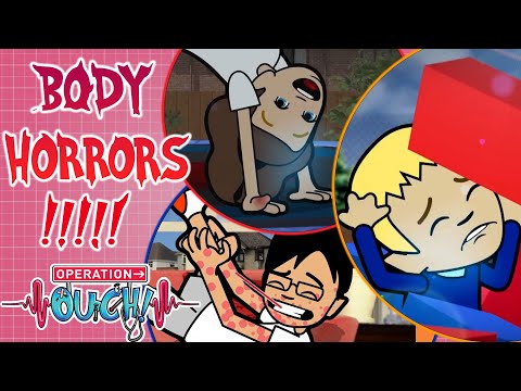 What Has Gone Wrong?! PART 3 | Body Horrors 😱 #Halloween | 30+ Mins Compilation | @OperationOuch ​