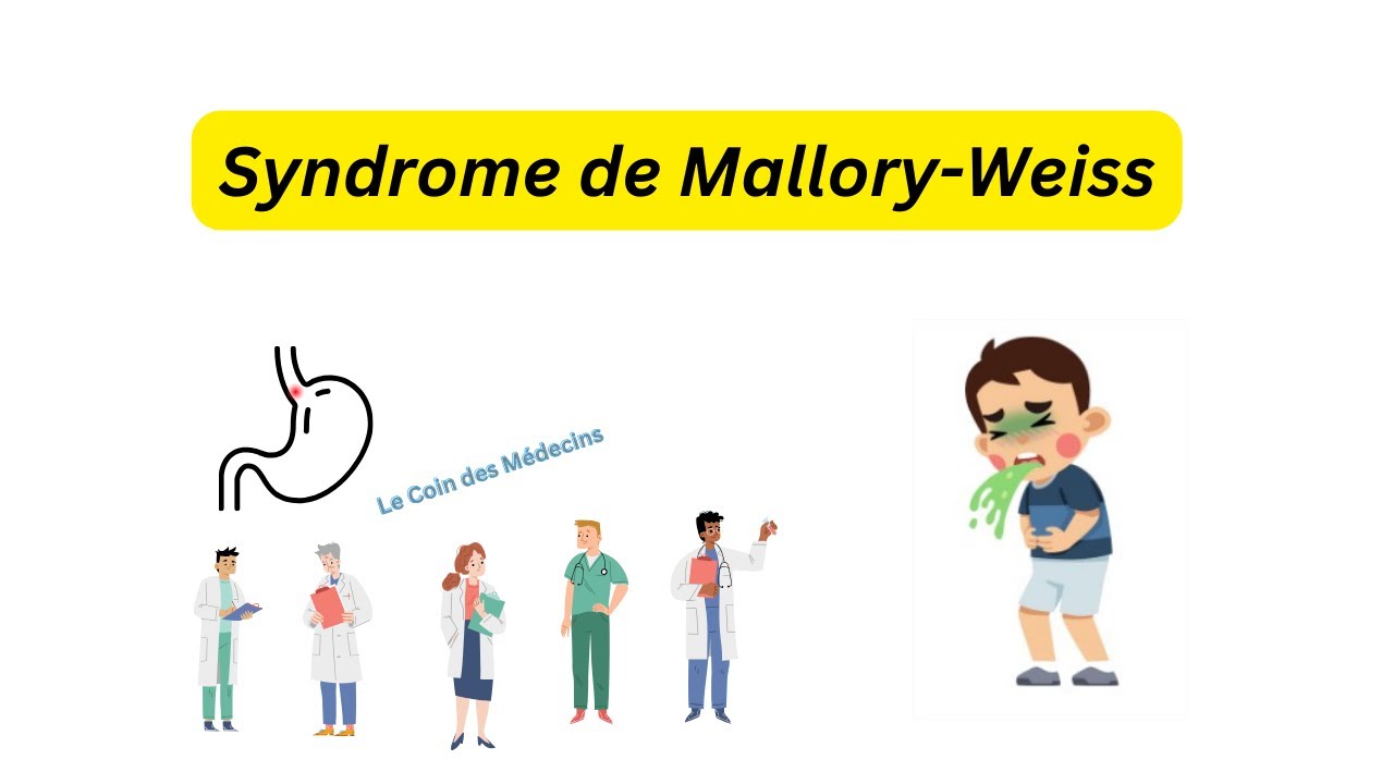 Syndrome de Mallory Weiss - YouTube