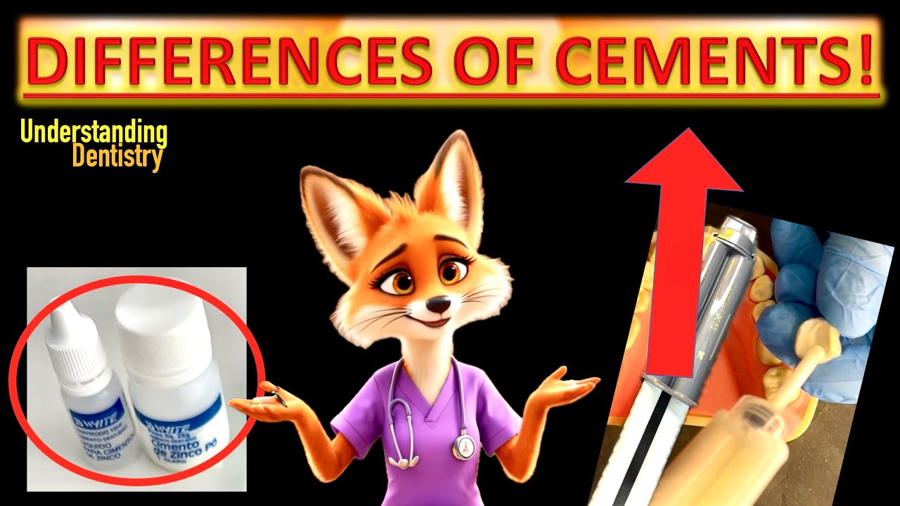 ALL Dental Cements: Differences, Basic Concepts, and Classification ...