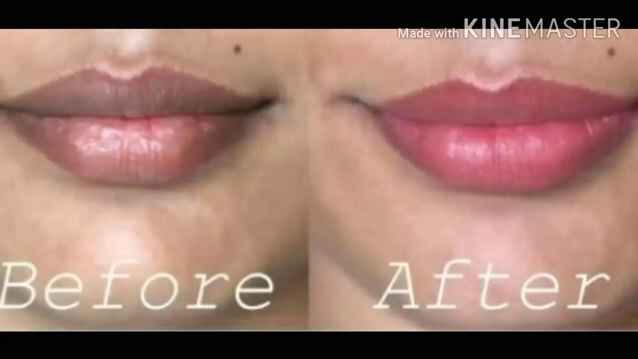 How to have pink lips / how to have fair lips / 200 % working - YouTube