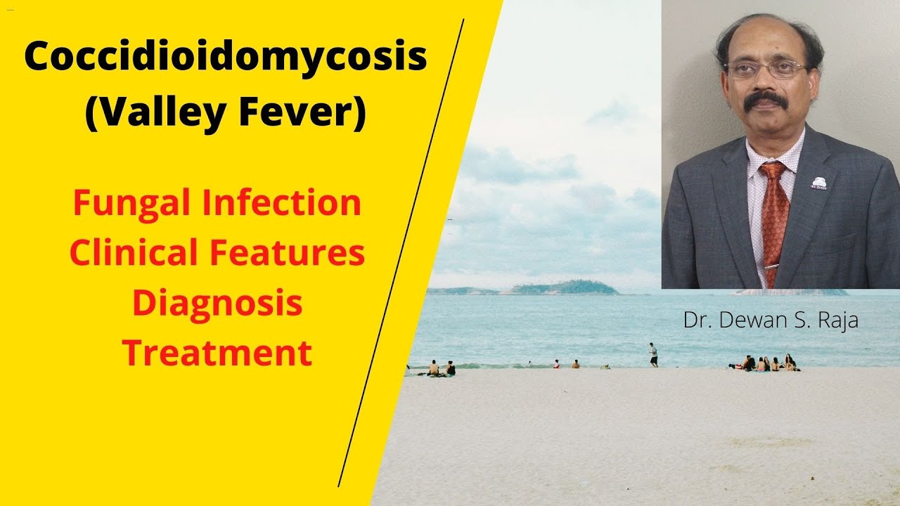 Coccidioidomycosis (Valley Fever) - YouTube