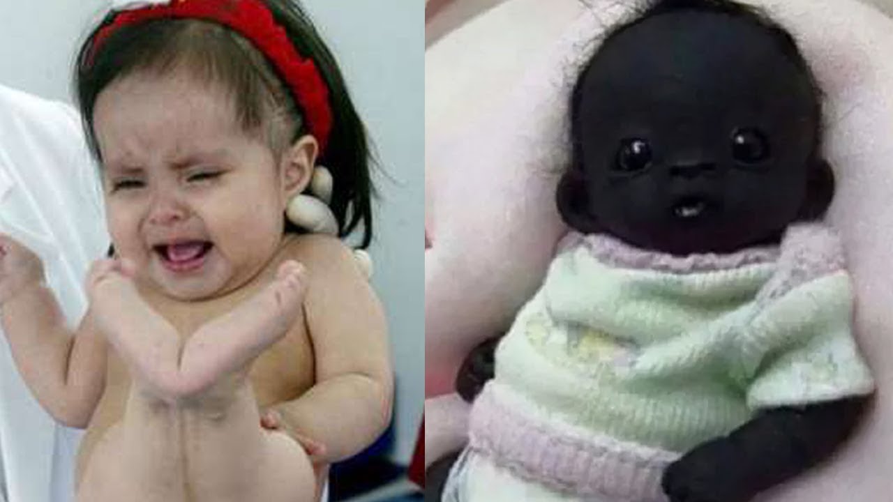 10 Real Babies Born With Incredible Features || Pastimers - YouTube