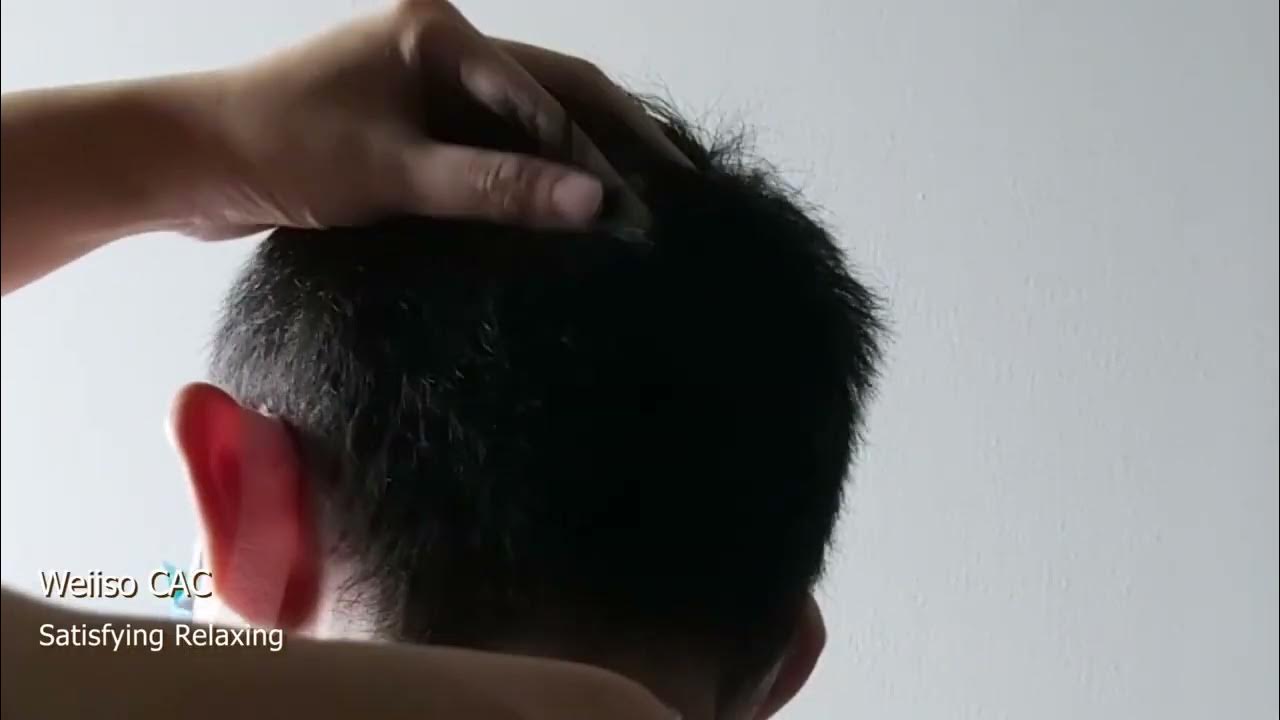 Satisfying Relaxing Cabut Uban #6 - YouTube