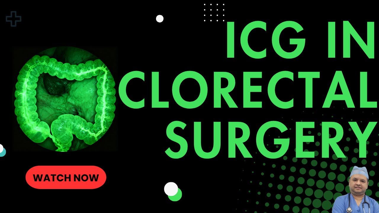 ICG guided colonic anastomosis | ICG in colorectal surgery | ICG In ...