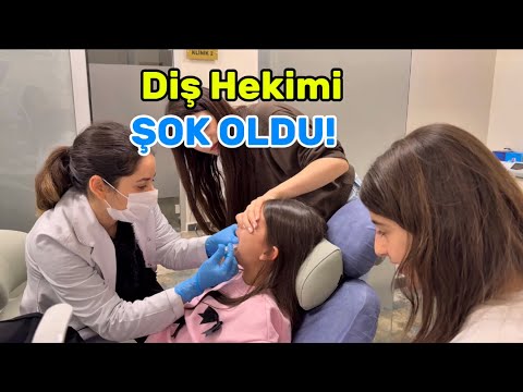 BU DİŞİ KİMSE BEKLEMİYORDU! 