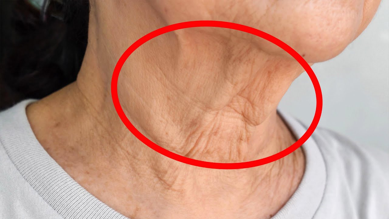 Tips for Preventing Signs of Aging Like ‘Turkey Neck’ - YouTube