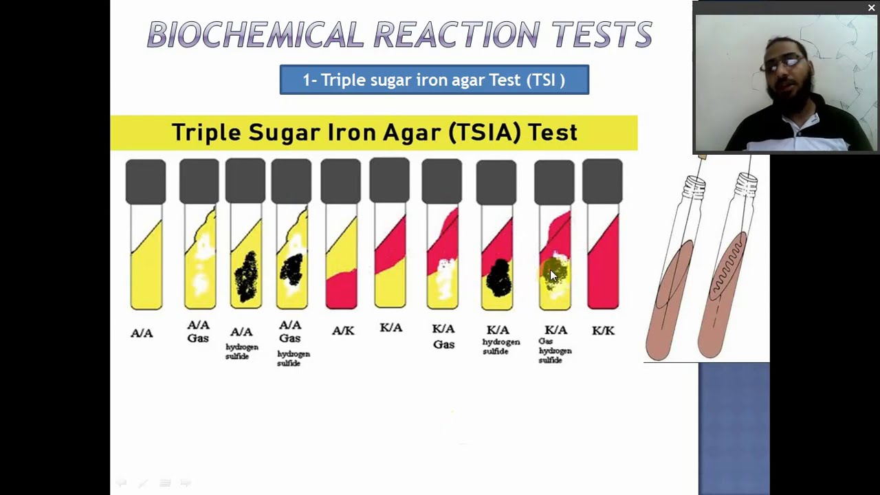 Gram Negative Bacilli Part 1 biochemical reaction in Gram Negative ...
