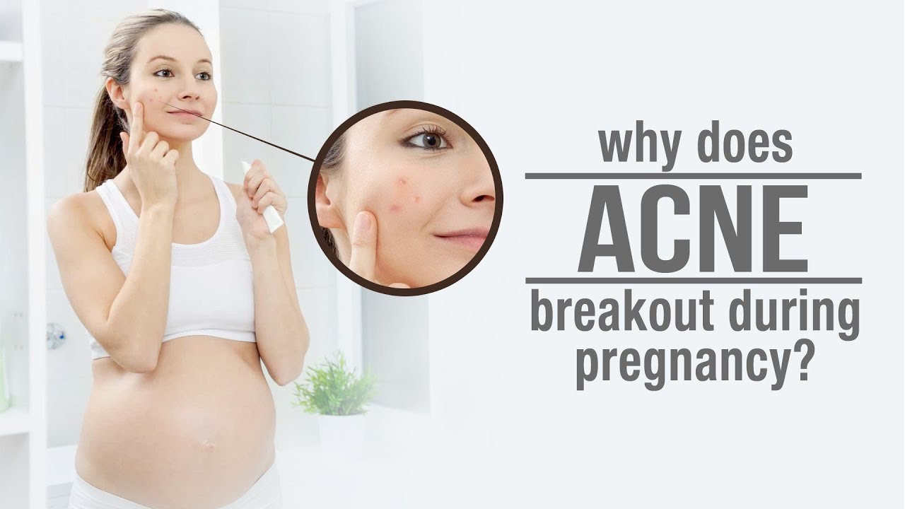 Why Does Acne Breakout During Pregnancy YouTube why-does-acne-breakout-during-pregnancy-youtube