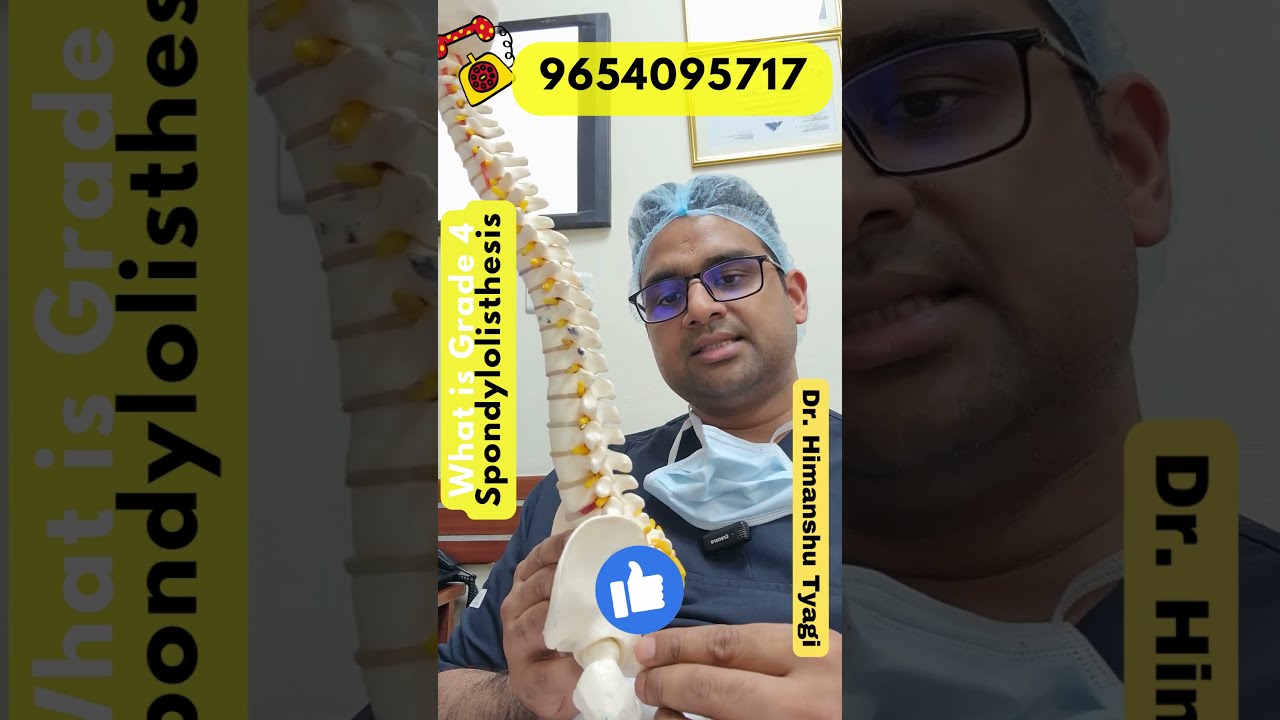 What Is Grade 4 Spondylolisthesis shorts shortsvideo spinesurgeon What Is Grade 4 Spondylolisthesis shorts shortsvideo spinesurgeon