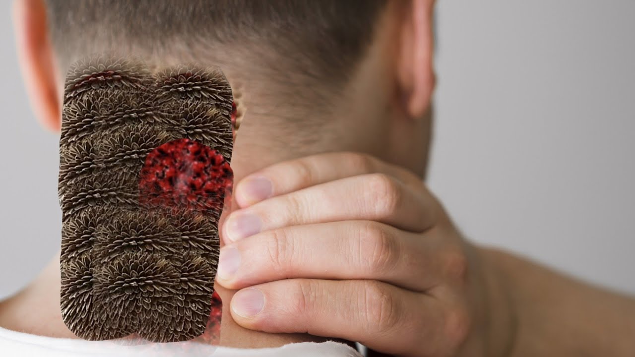 Neck Wound Treatment Properly - YouTube