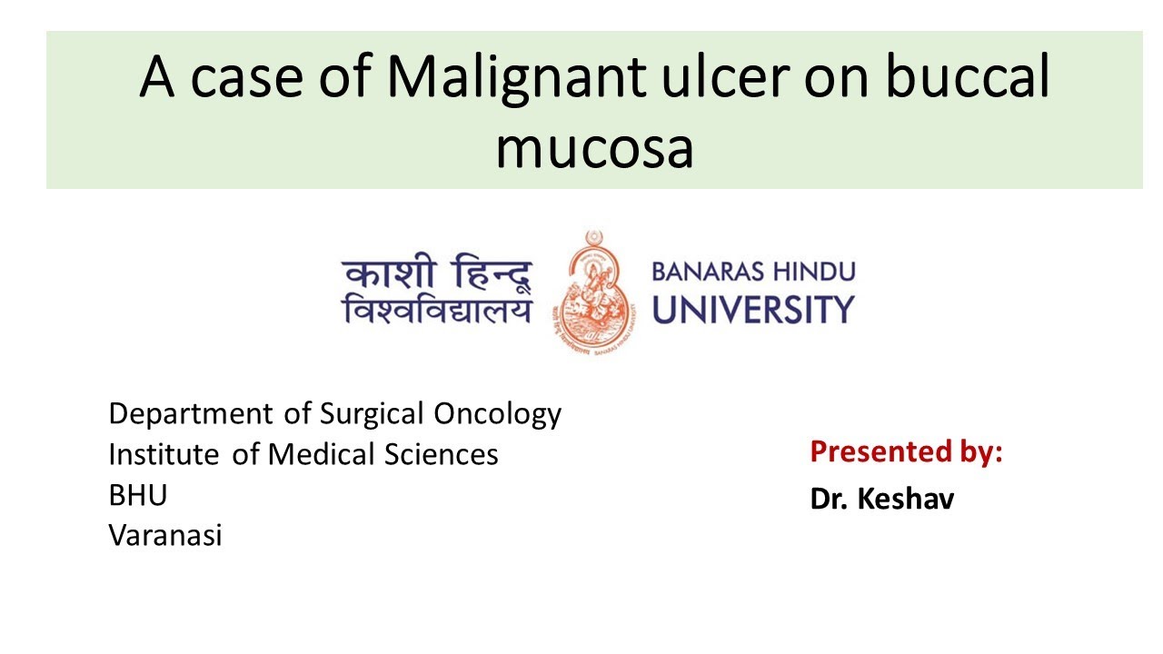 A case of malignant ulcer of buccal mucosa - YouTube