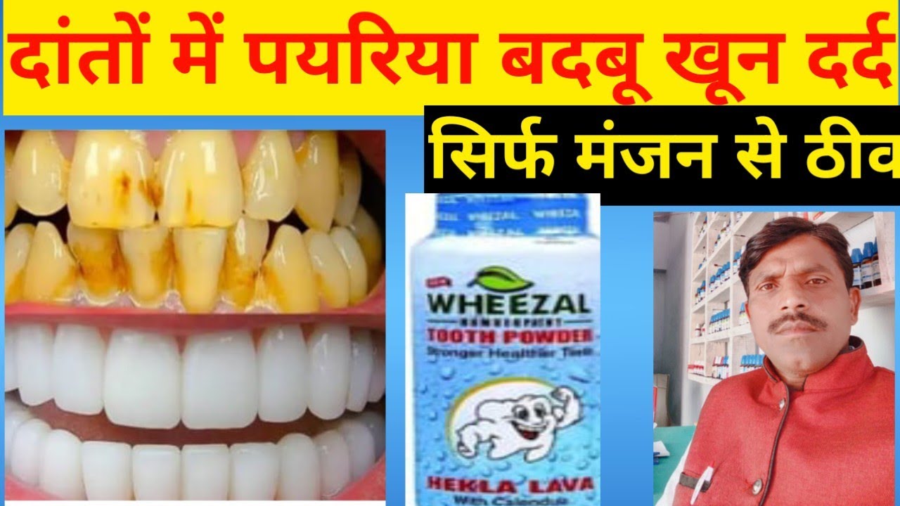 Hekla lava tooth powder Homeopathic medicine for pyorrhea How To Whiten ...