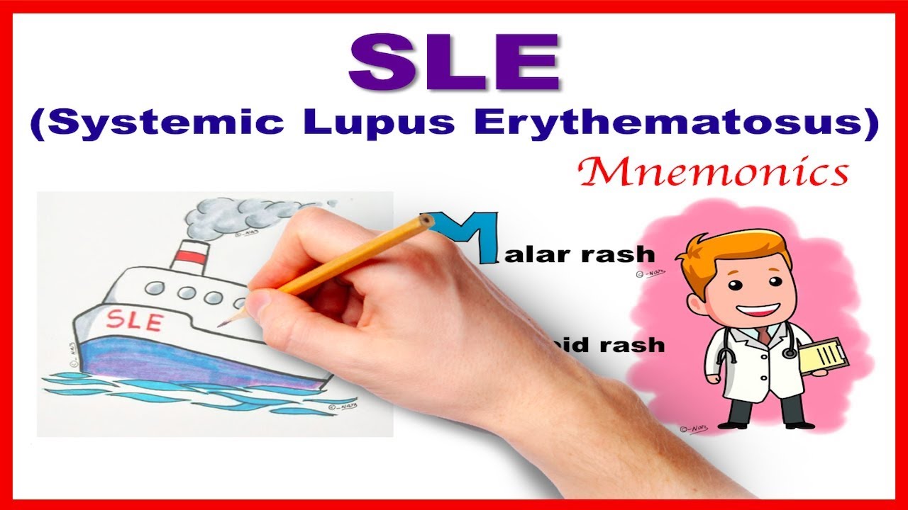 Systemic Lupus Erythematosus : Mnemonic series # 25 - YouTube