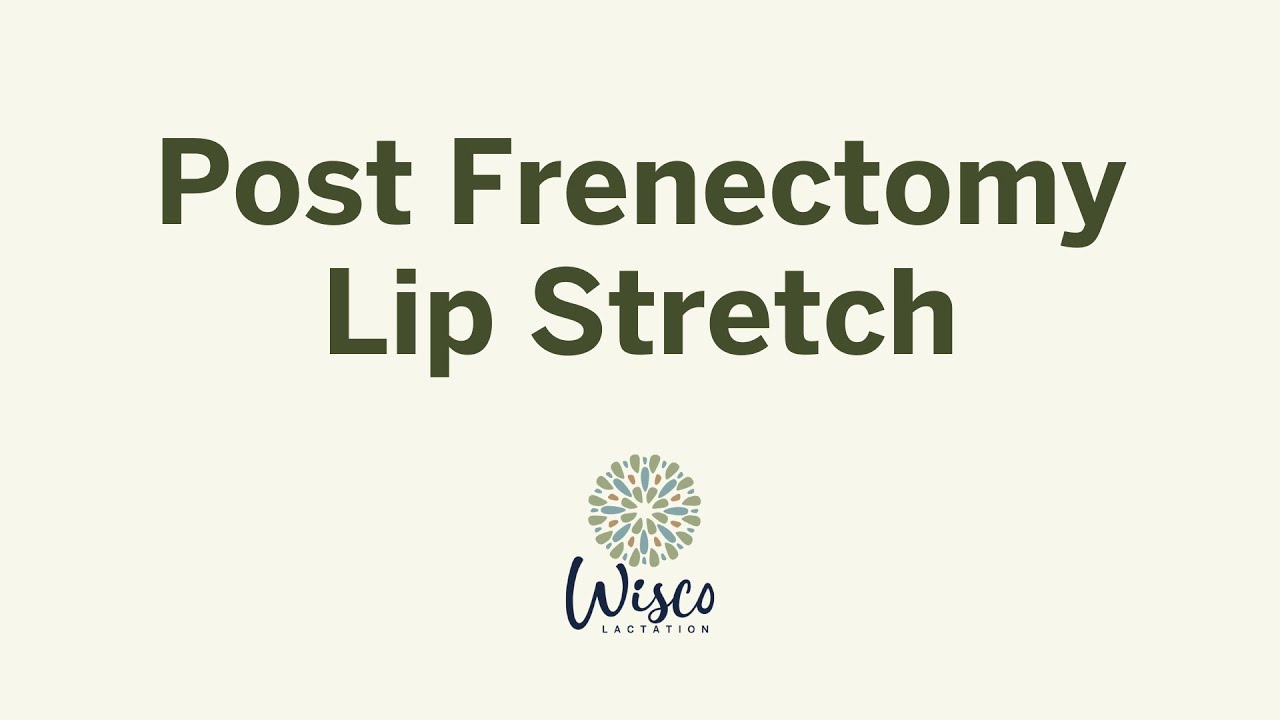 Post Frenectomy Lip Stretch - YouTube