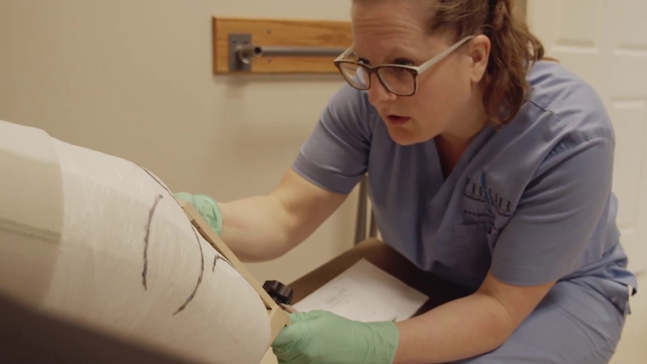 ProCare's Casting and Fitting Process - YouTube