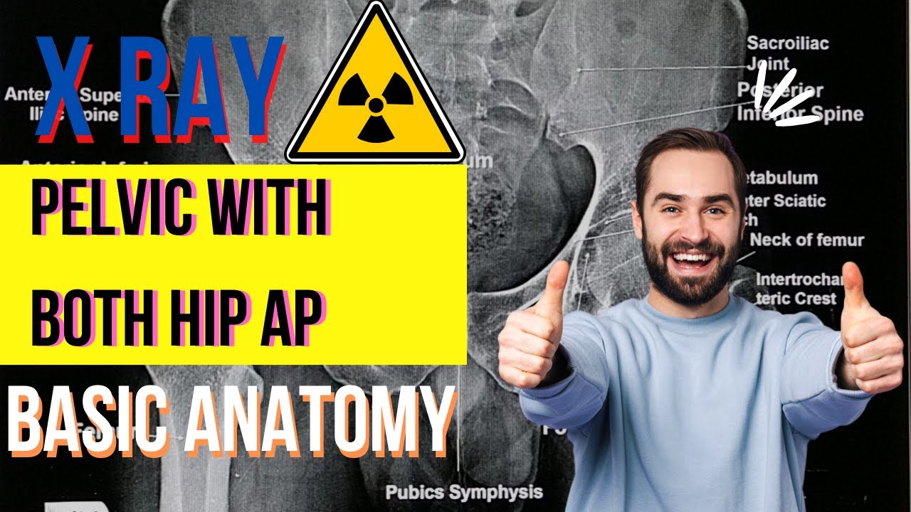 pelvic x ray | x ray pelvis ap view | pelvis with bilateral hip ap ...