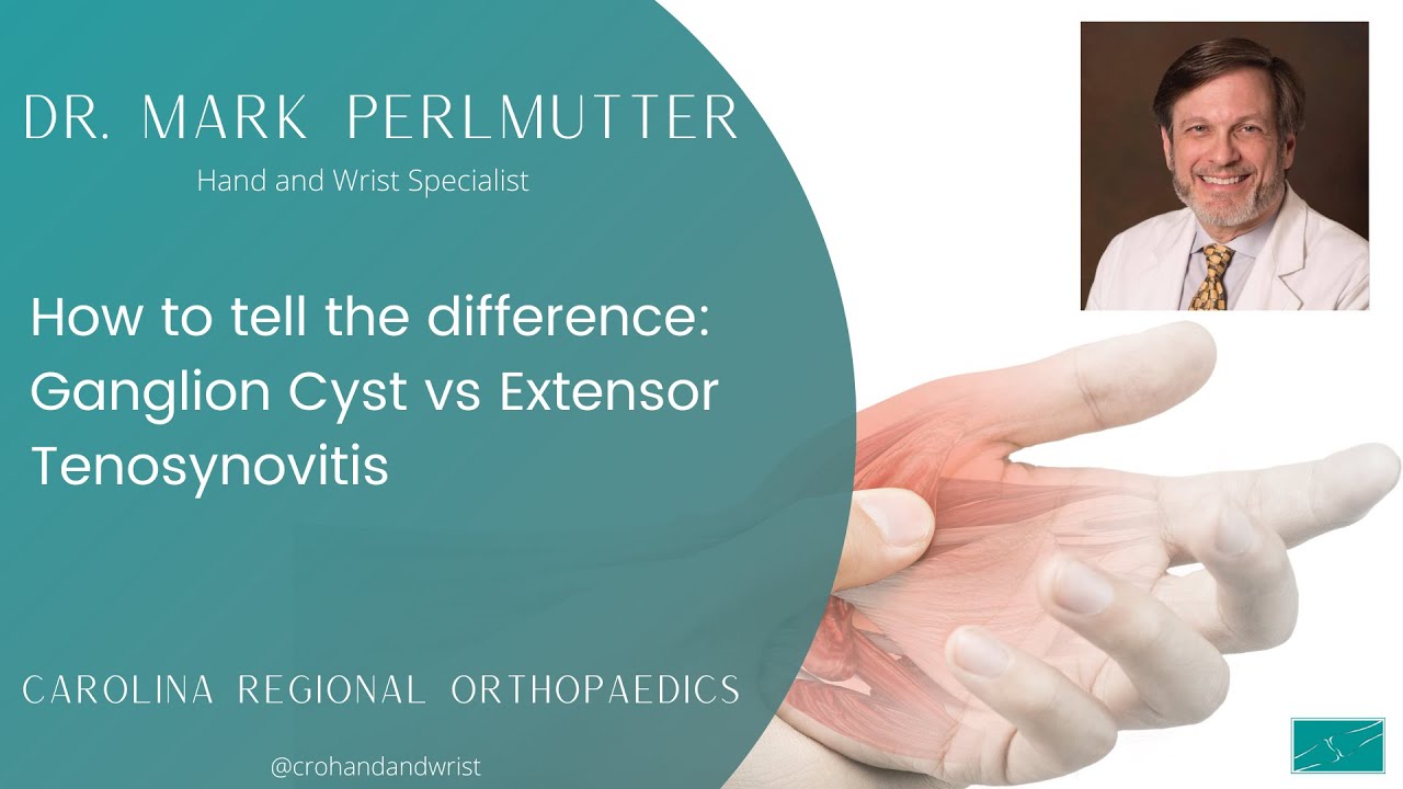 How to tell the difference: Ganglion Cyst vs Extensor Tenosynovitis ...