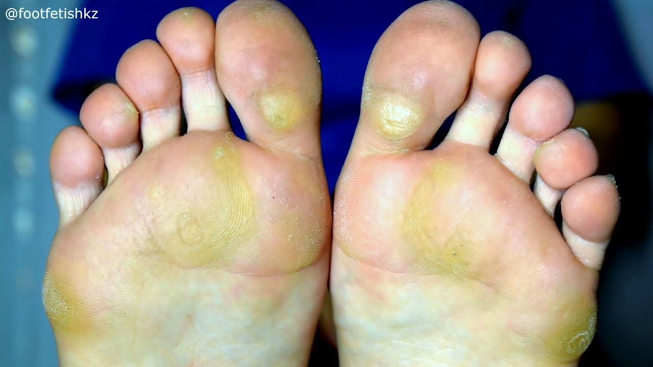 Feet Soles Girl Fullhd 84 Youtube