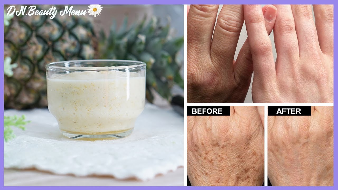 Younger Hands Menu 2: Smooth and soft hands, Reduce hand wrinkles Dark ...