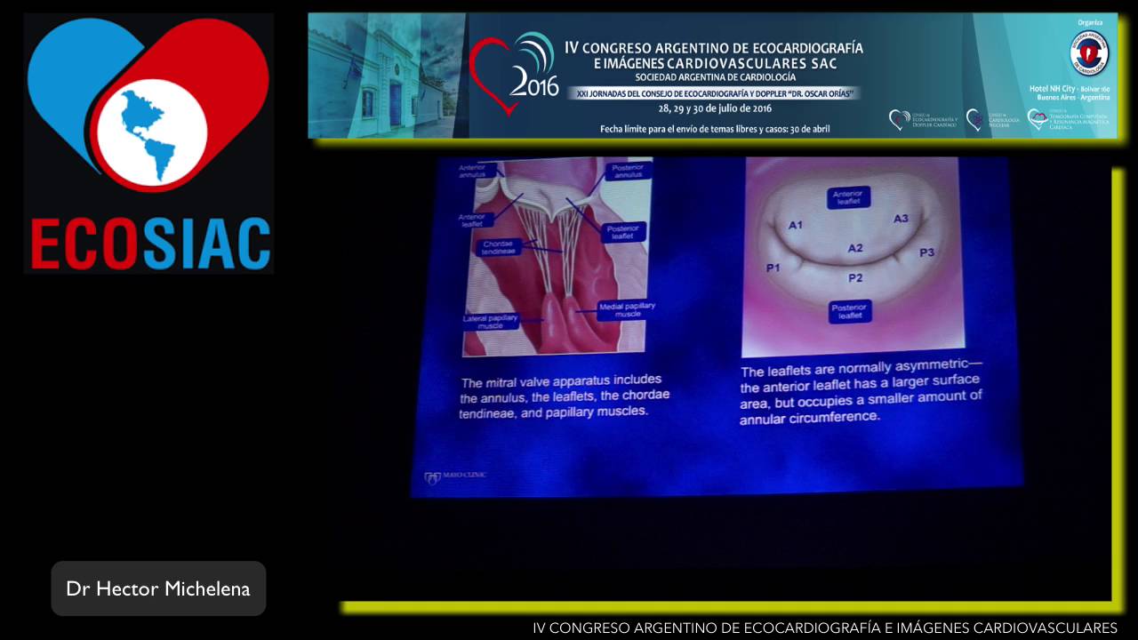 CardioImagen - "Tratamiento percutáneo de la insuficiencia mitral" Dr ...