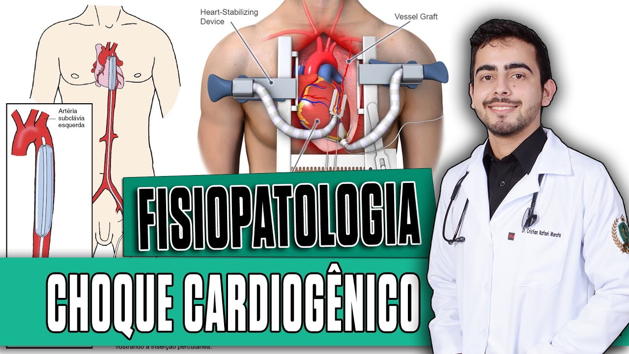 Choque Cardiogênico [PARTE 2/4] │ Fisiopatologia - YouTube