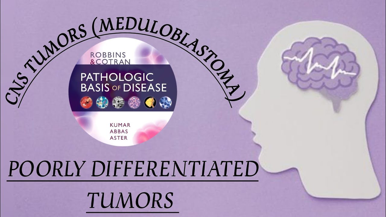 CNS TUMORS PATHOLOGY (PART-8) MEDULLOBLASTOMA |ROBBINS BASIS| - YouTube