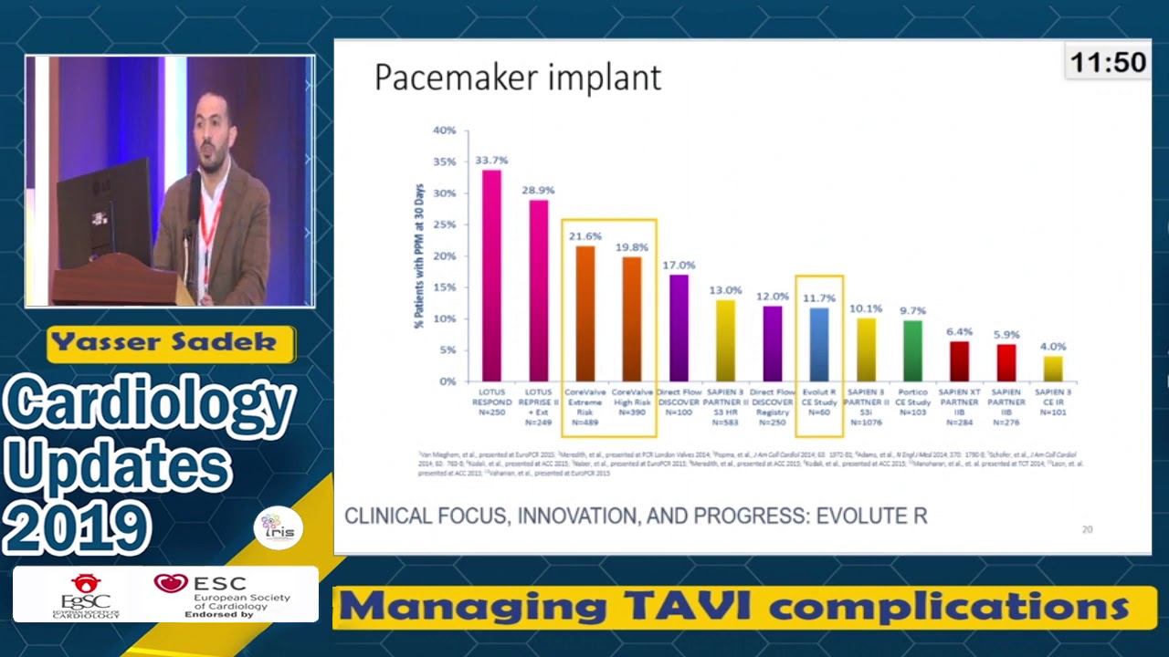 Managing TAVI Complications Prof Yasser Sadek - YouTube