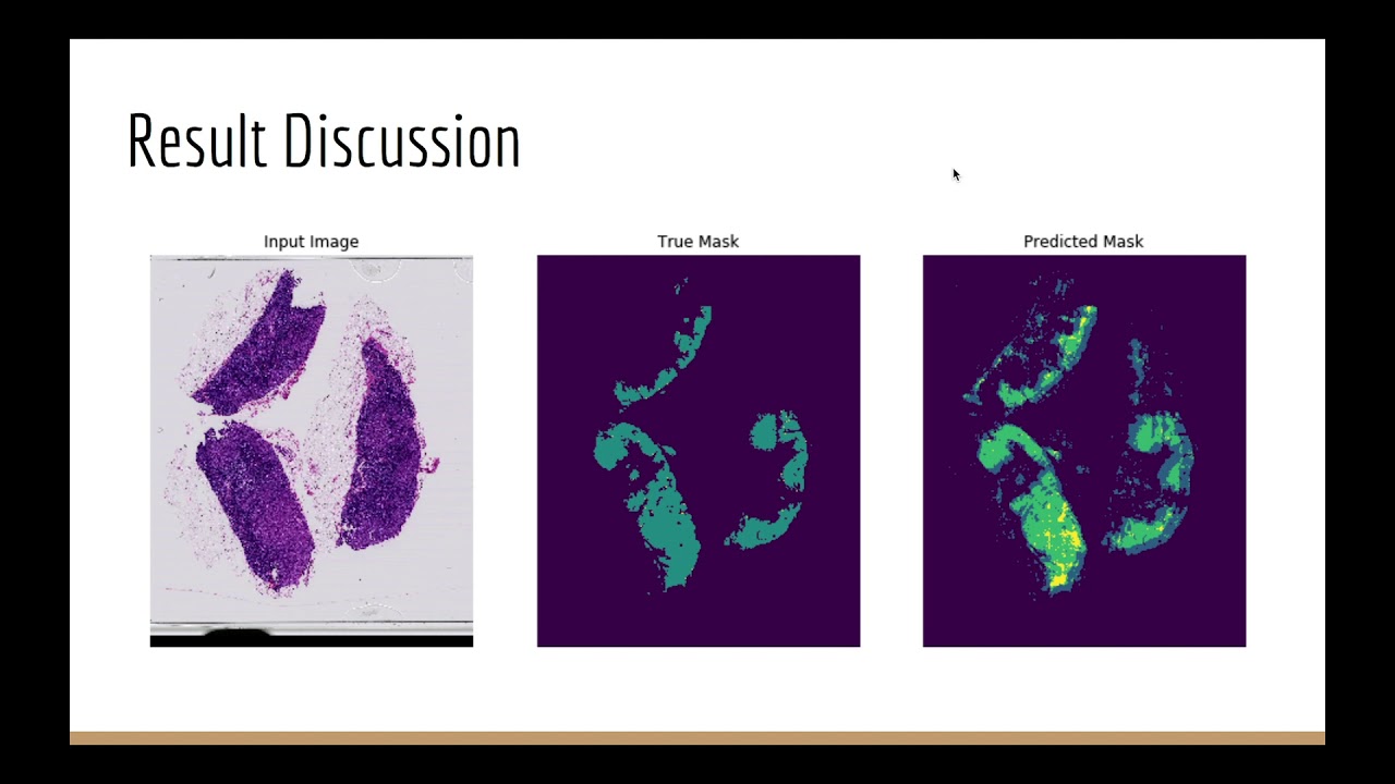Applied Deep Learning Project - Detecting Cancer in Gigapixel Pathology Images - YouTube